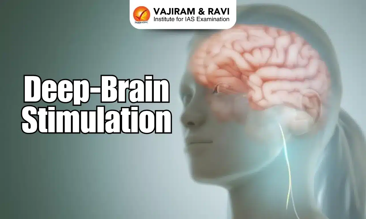Deep Brain Stimulation Meaning Advantages Applications Latest News